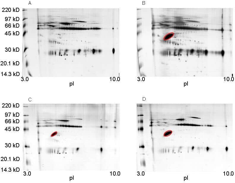 Optimising cerebrospinal fluid preparation for 2-D electrophoresis ...