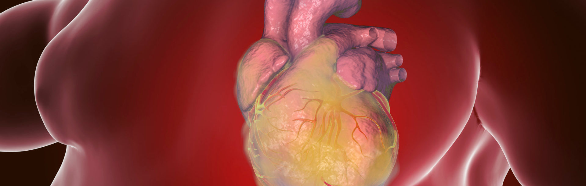 Cardiometabolic Dysfunction in Obesity - The Physiological Society