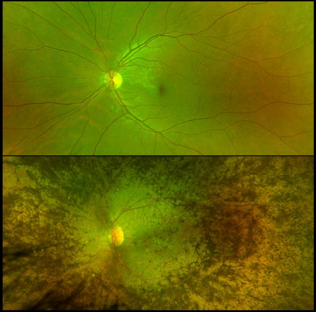 Photoreceptors in health and monogenic disease – from 500 million years ...