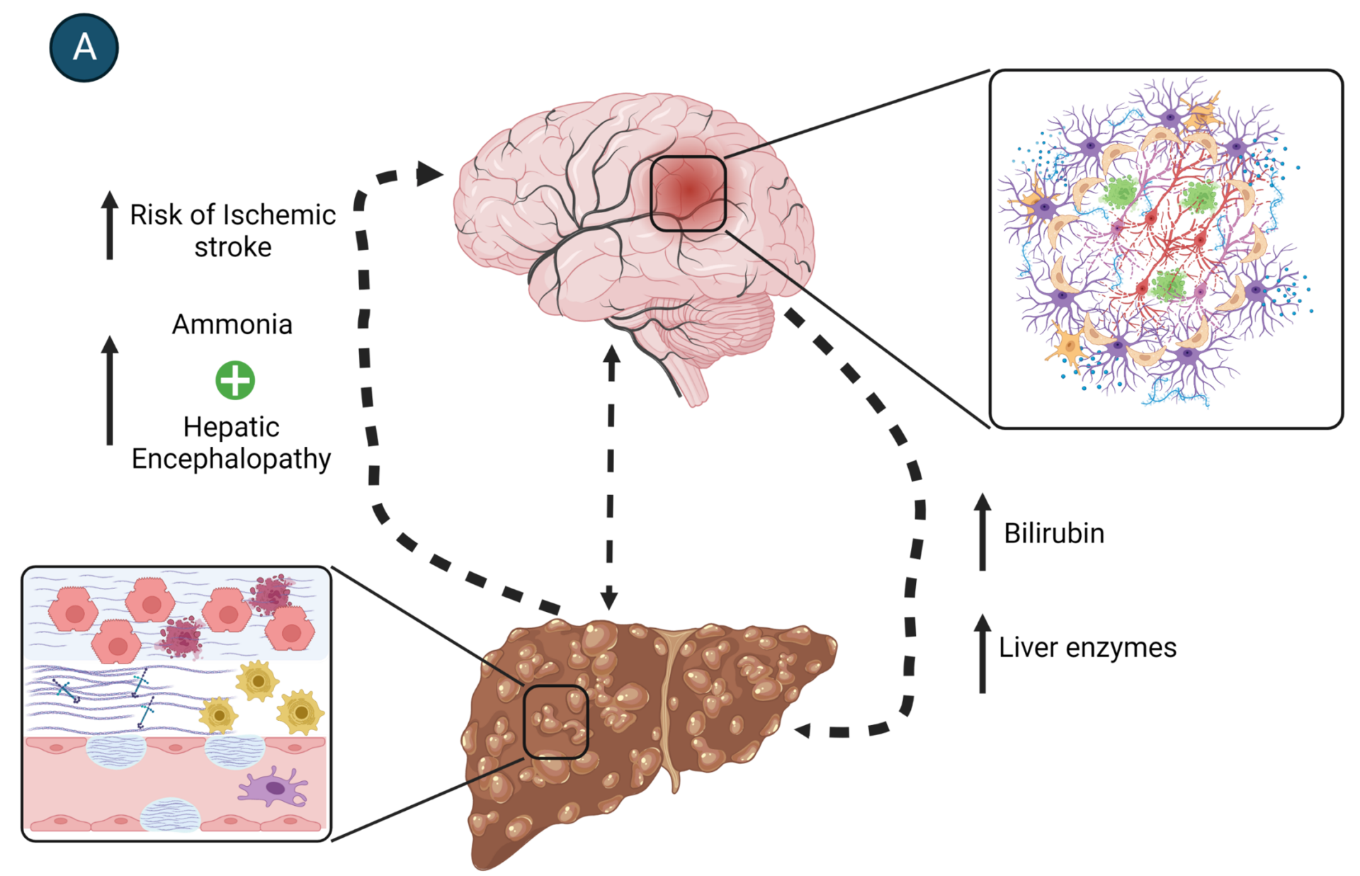 Astrocytes and hepatic stellate cells (HSCs): Stars of tissue ...
