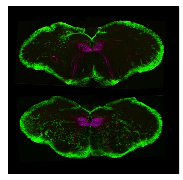 Why a high fat diet could reduce the brain’s ability to regulate food ...